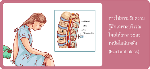 Painless labor คืออะไร ต่างจากคลอดธรรมชาติแบบปกติยังไง : โรงพยาบาลวัฒน ...